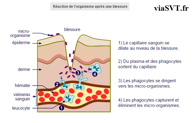 Réaction Inflammatoire Blessure Svt Vive Les Svt Les Sciences De La
