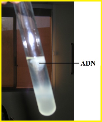 Comment extraire de l’ADN de cellules ? | Vive les SVT ! Les sciences ...