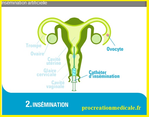 l’insémination artificielle svt animation | Vive les SVT ! Les sciences ...