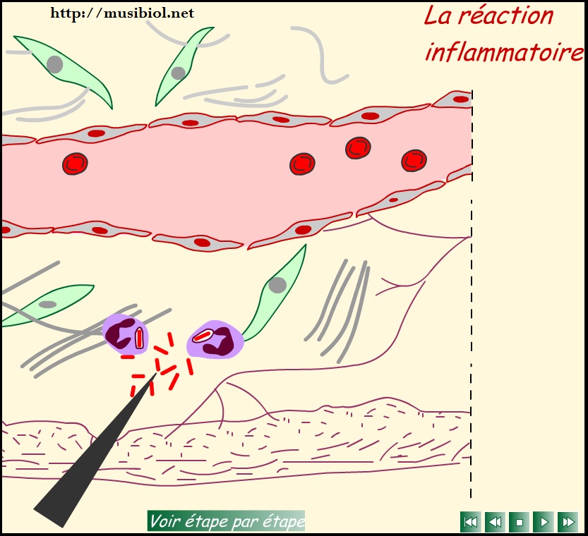 la réaction inflammatoire | Vive les SVT ! Les sciences de la vie et de ...