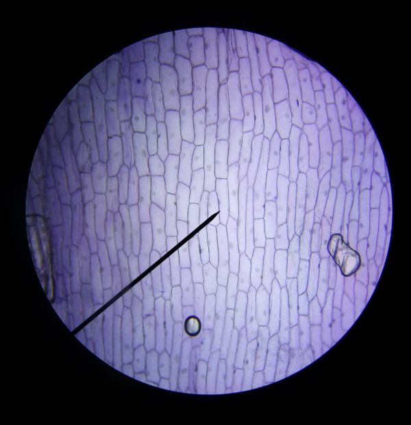 Cellules observées au microscope SVT noyau cytoplasme membrane ...
