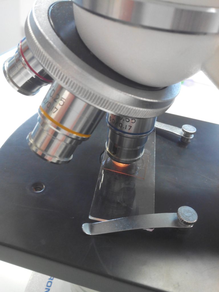 Cellules observées au microscope SVT noyau cytoplasme membrane ...
