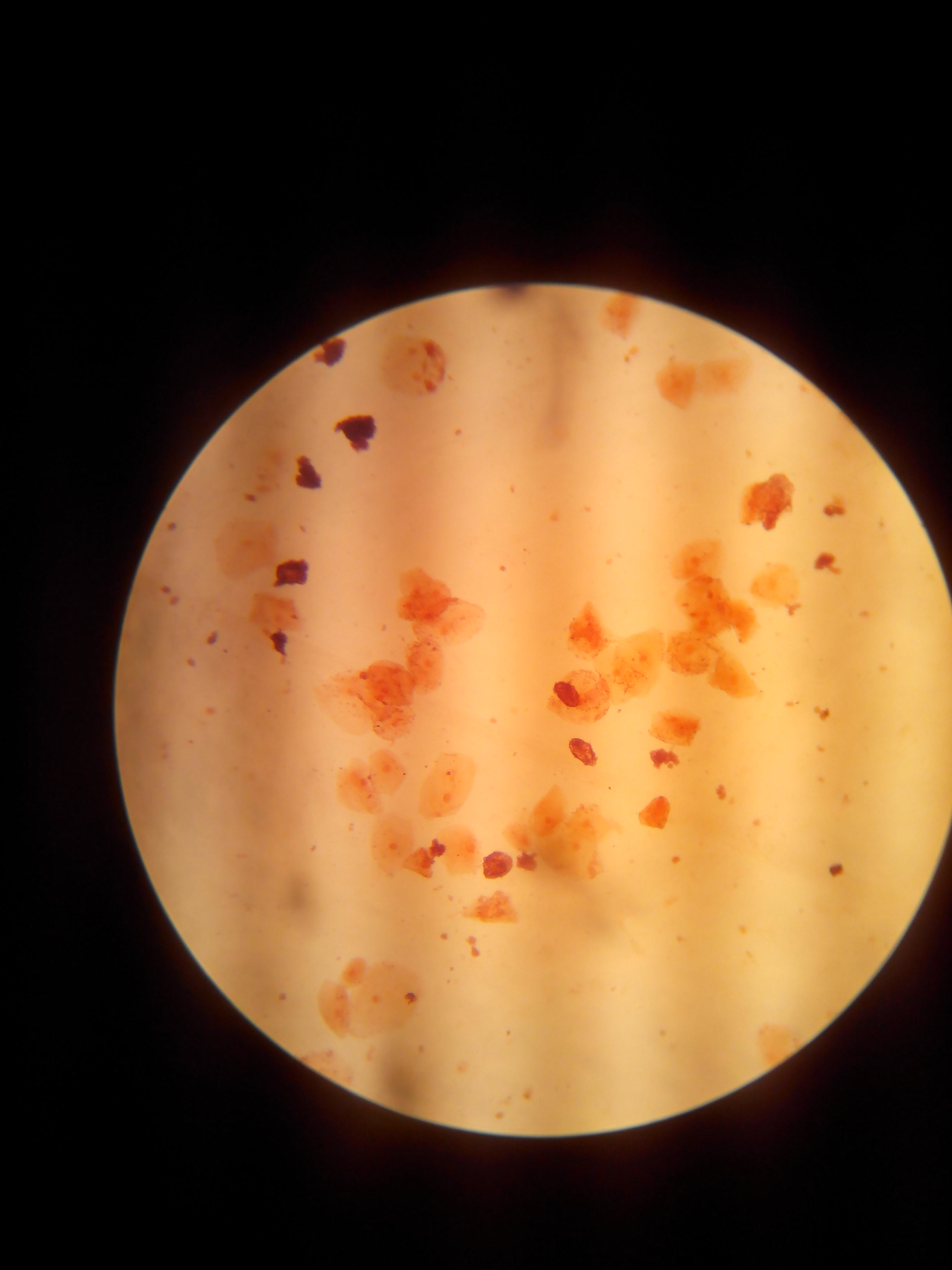 Cellules observées au microscope SVT noyau cytoplasme membrane ...