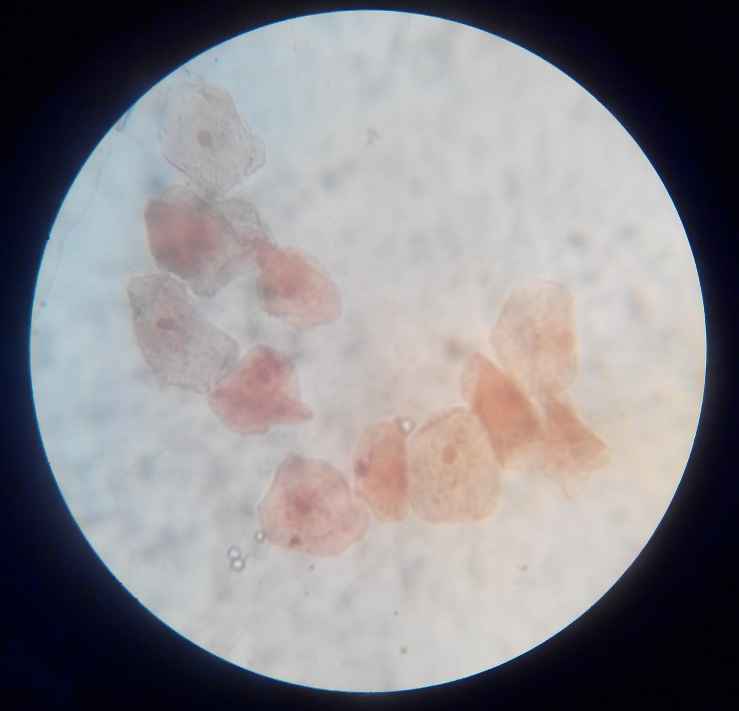 Cellules observées au microscope SVT noyau cytoplasme membrane ...