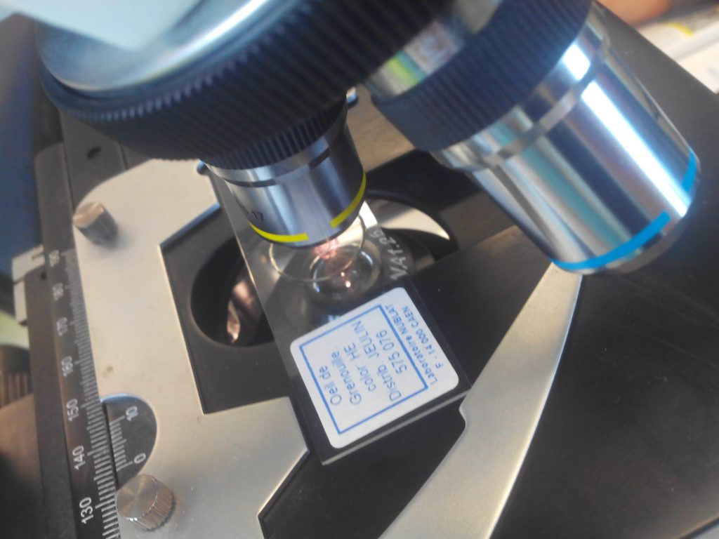 Observation microscopique rétine SVT oeil vision (1) | Vive les SVT ...