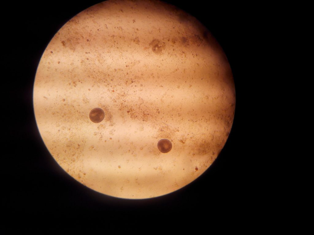 Photographies cellules reproductrices spermatozoïdes ou ovules (11 ...