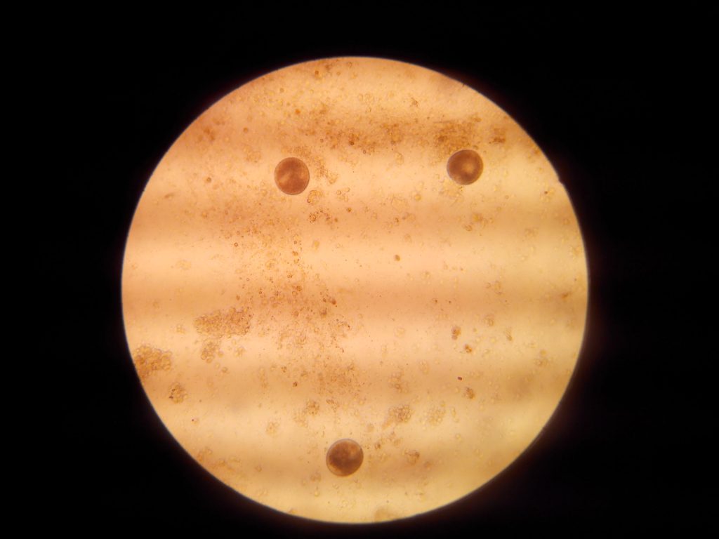 Photographies cellules reproductrices spermatozoïdes ou ovules (12 ...