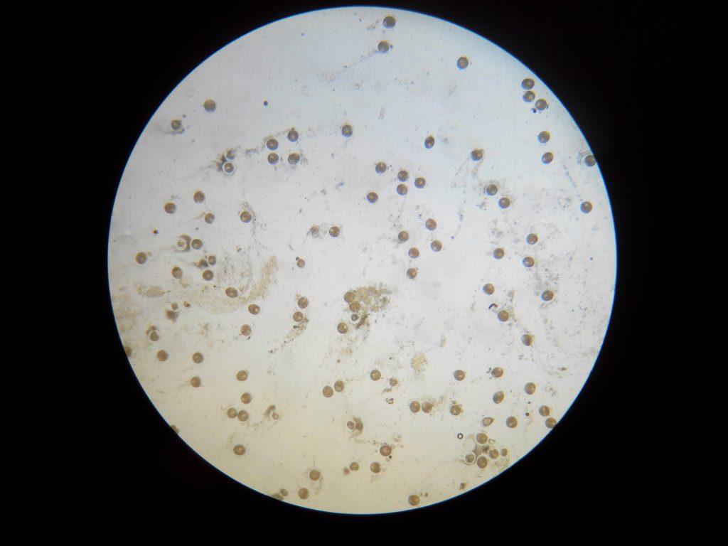 Photographies cellules reproductrices spermatozoïdes ou ovules (15 ...