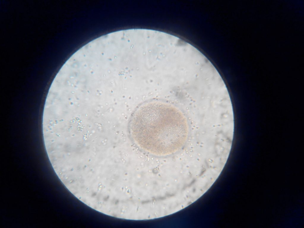 Photographies cellules reproductrices spermatozoïdes ou ovules (18 ...