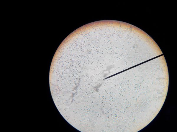 Photographies cellules reproductrices spermatozoïdes ou ovules (20 ...