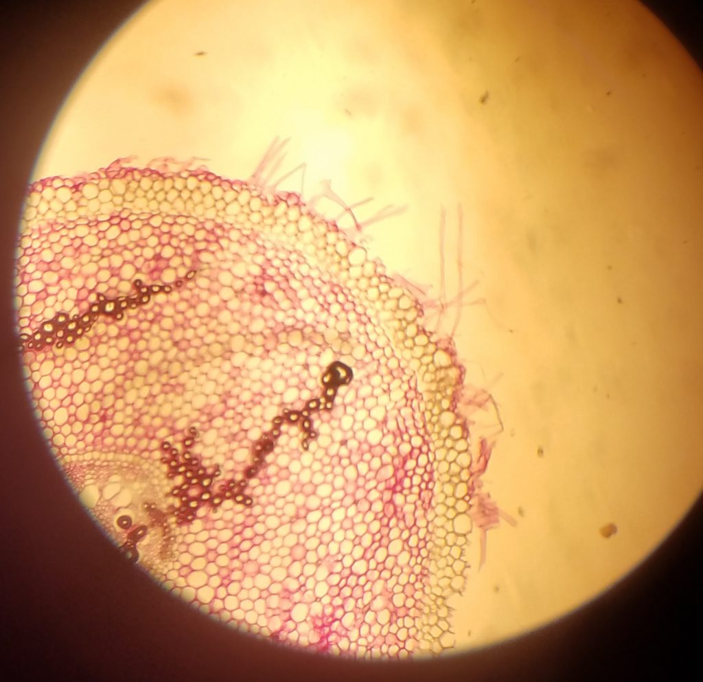 coupe de racine poils absorbants SVT nutrition végétale (1) | Vive les ...